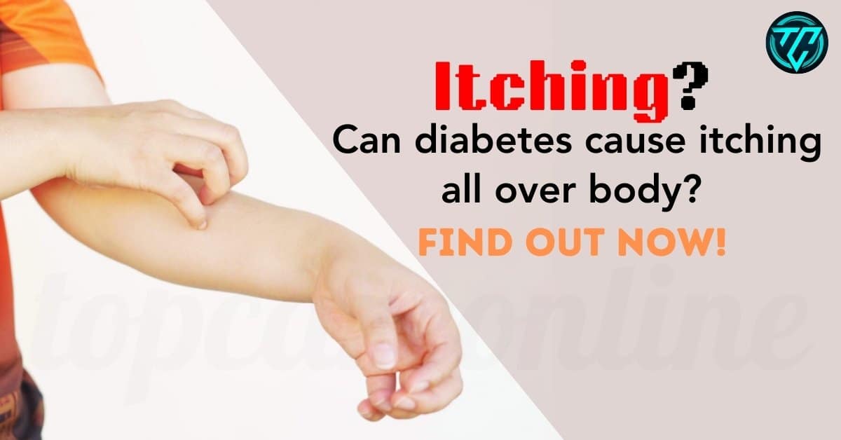Itching? Can diabetes cause itching all over body? Find Out Now ...